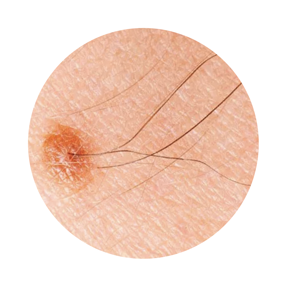 the process - Skin Therapy & Treatments in Yorkshire