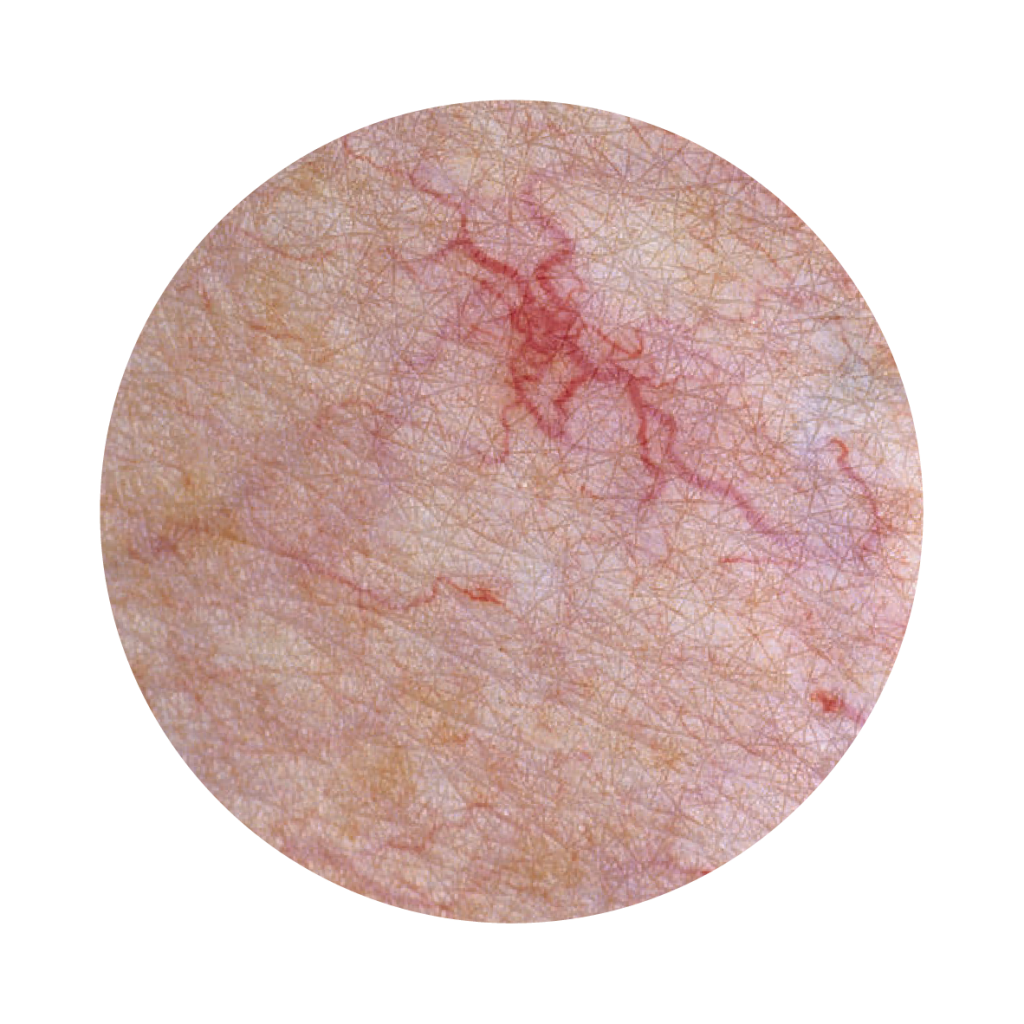 the process - Skin Therapy & Treatments in Yorkshire